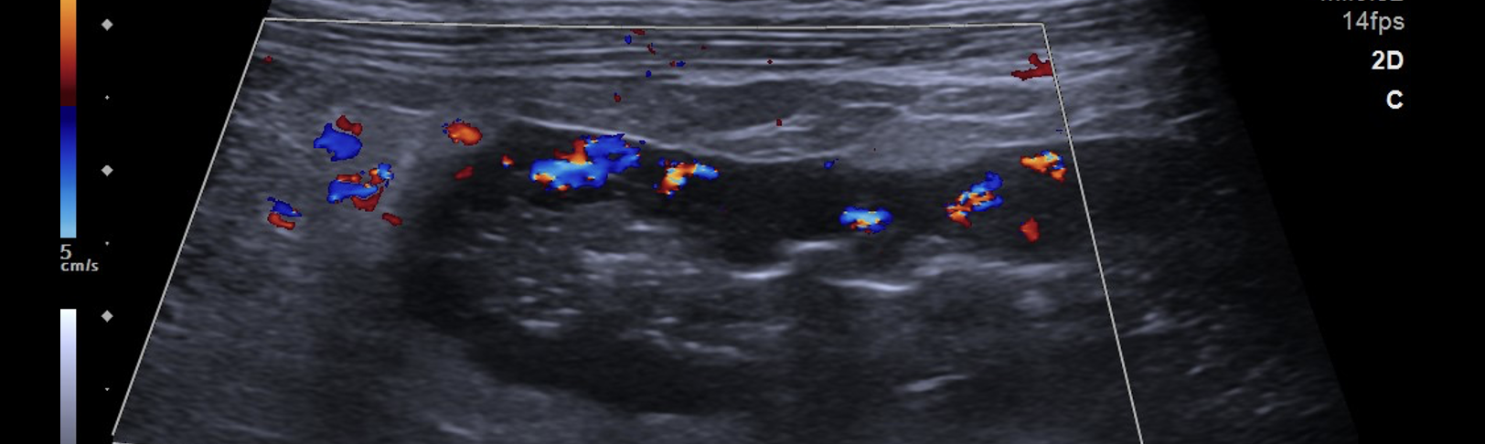 Learning HUB – IBUS – International Bowel Ultrasound Group